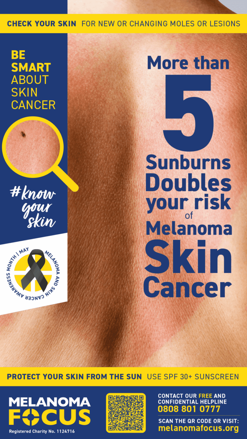 Skin Cancer - Cancer Matters Wessex